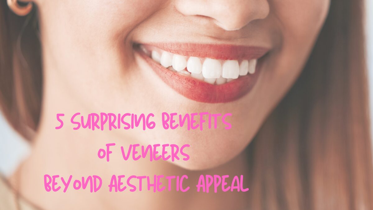 Cosmetic Dentistry Procedure: Veneers